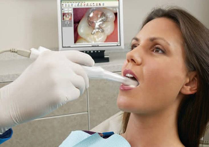 Intra-Oral Camera